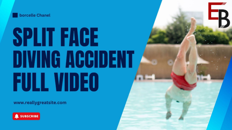 Split Face Diving Accident Full Video Guide in 2023 - A Complete Guide